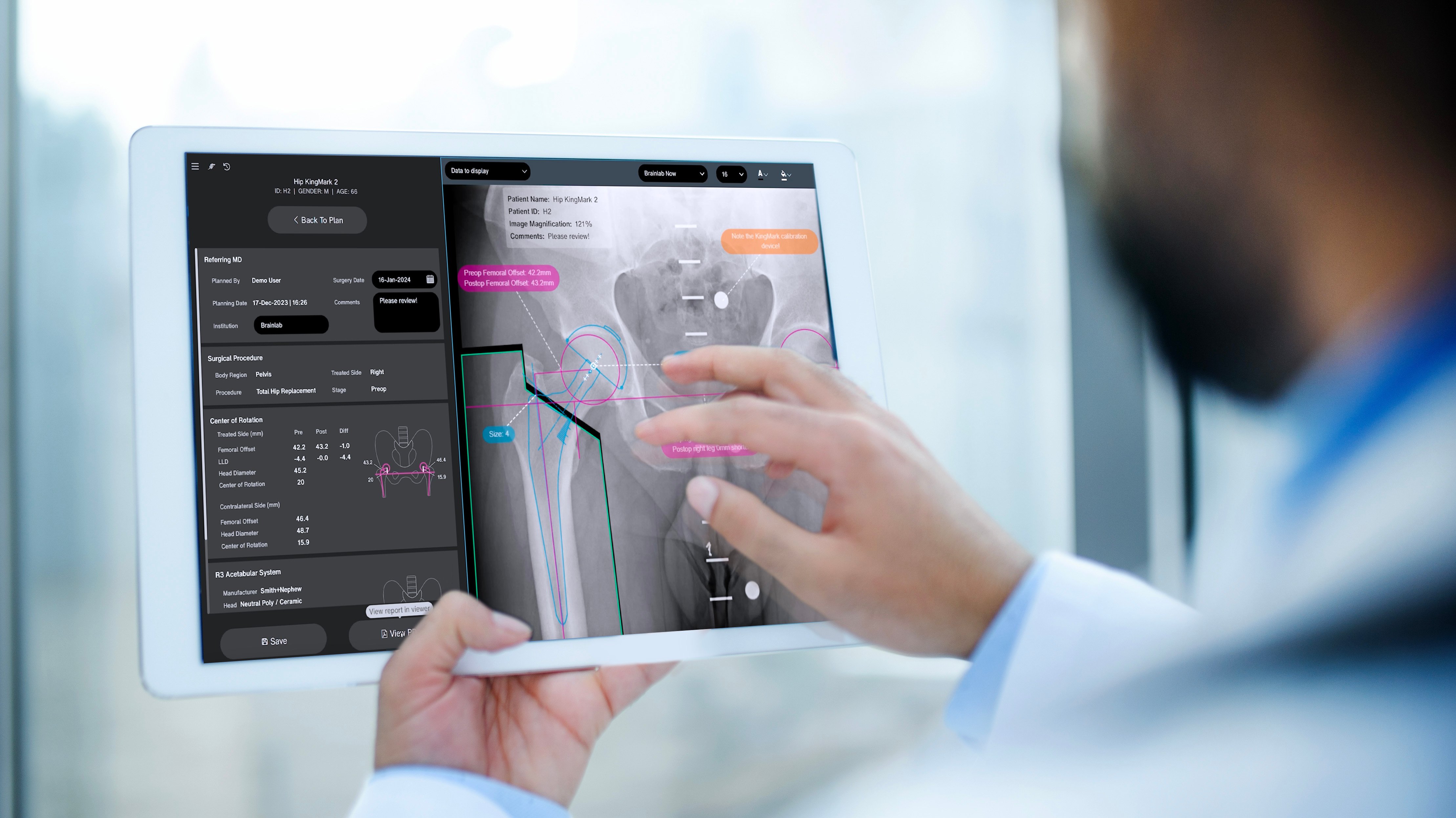 TraumaCad Neo | Brainlab